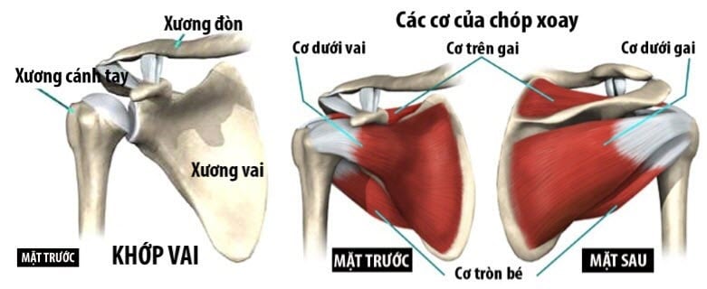 Những điều cần biết về đau vai do rách chóp xoay khớp vai | Alo Bác Sĩ